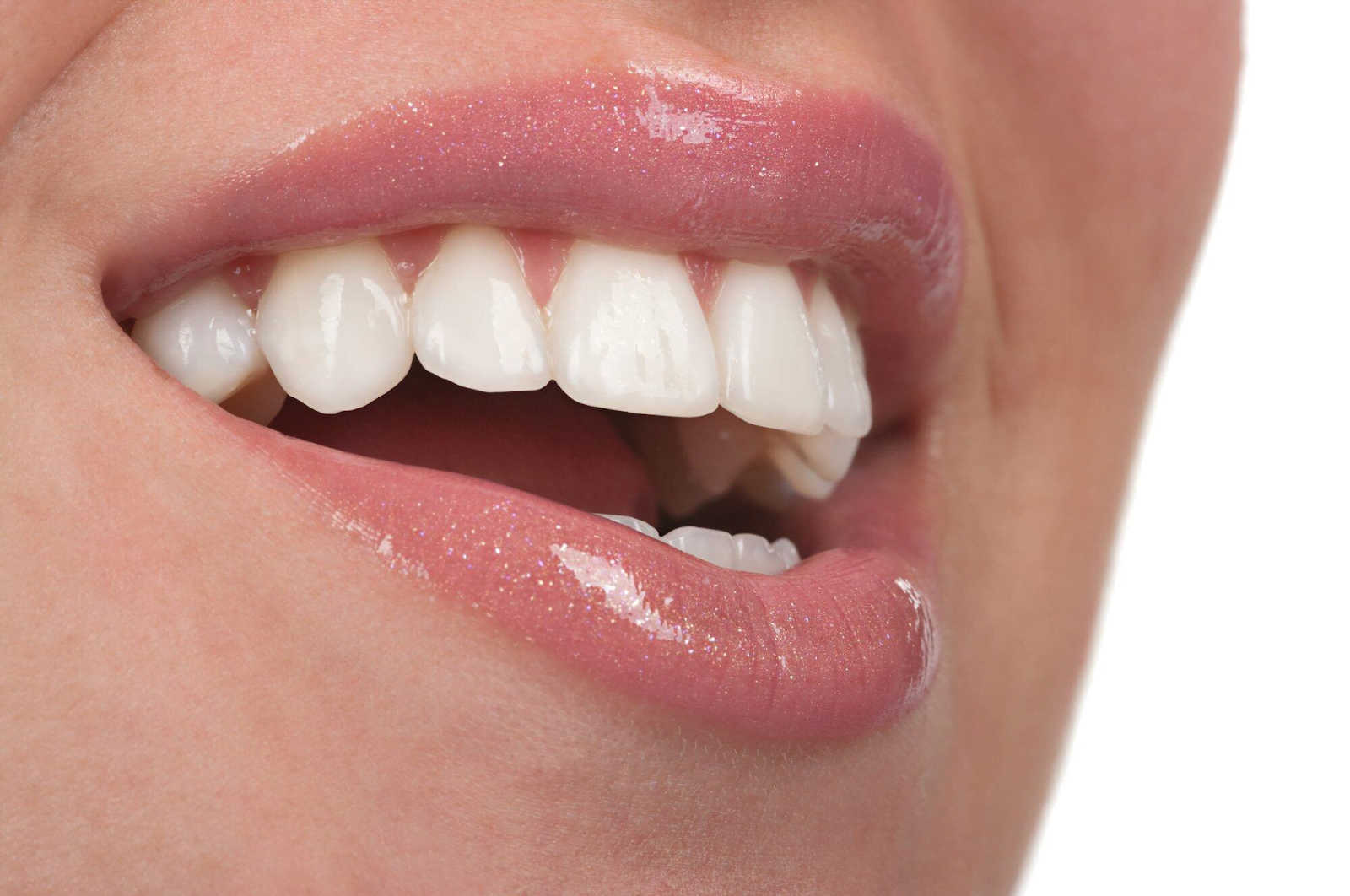 From Flaws to Perfection: A Look at Veneers Before and After Journey